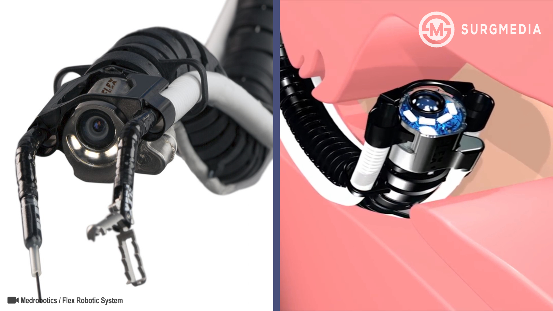 Flexible Robotic System Offers Articulated Scope for Laryngeal and ...